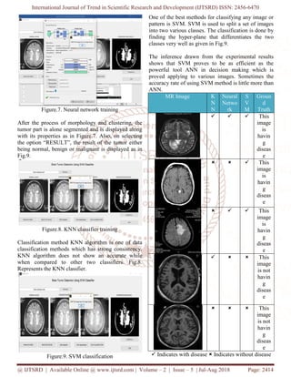 SVM Classifiers at it Bests in Brain Tumor Detection using MR Images | PDF