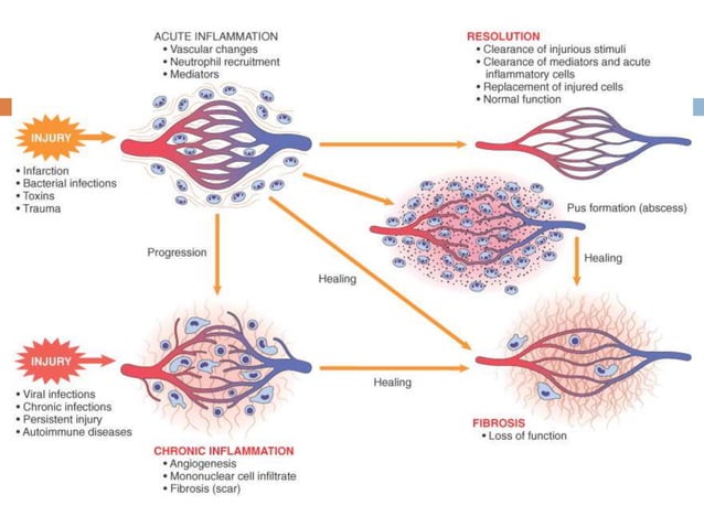 Konsep Inflamasi dan peradangan pada perawat | PPTX