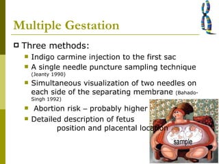 37233502 amniocentesis-and-cvs | PPT