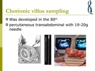 37233502 amniocentesis-and-cvs | PPT