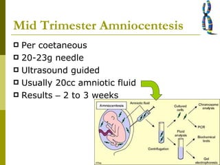 37233502 amniocentesis-and-cvs | PPT