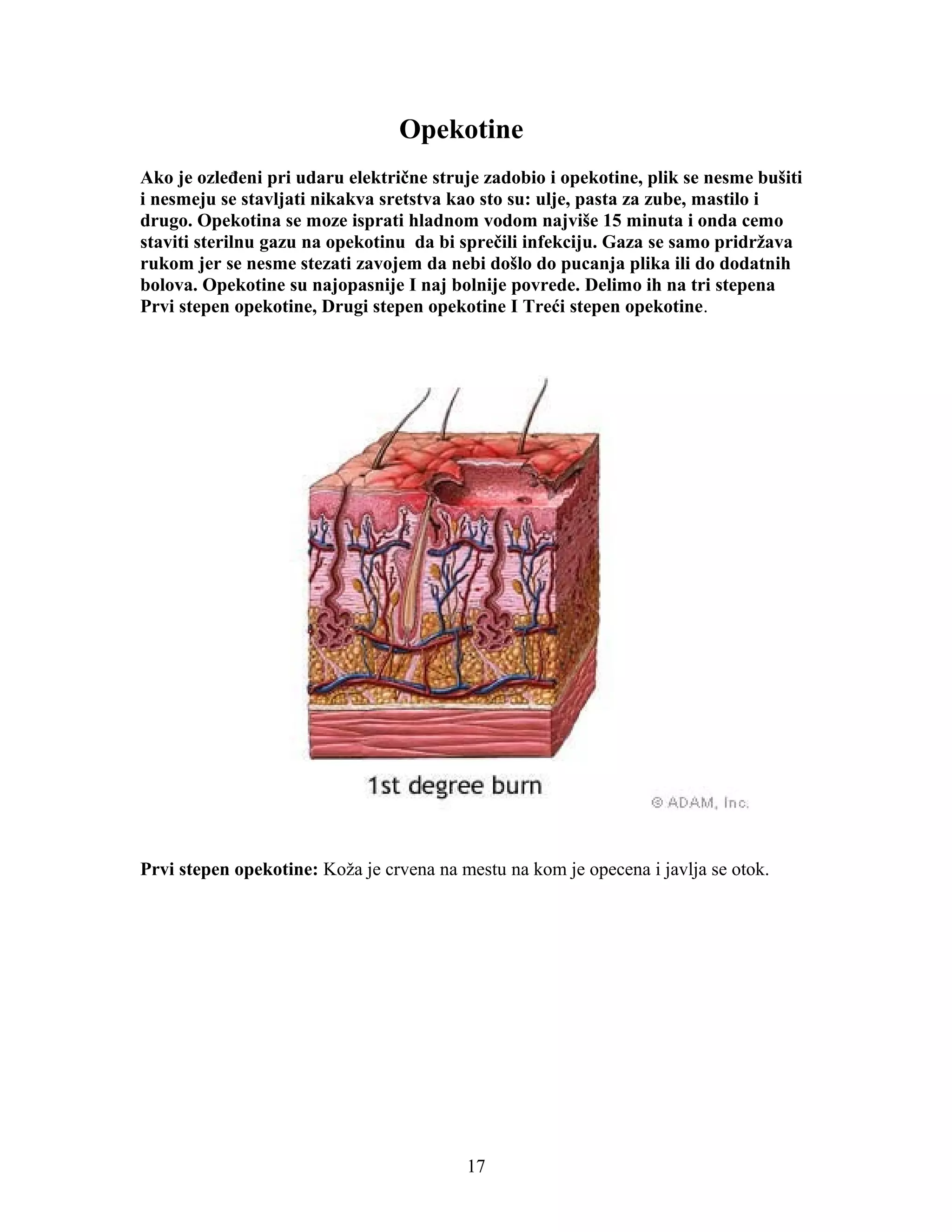 Pruzanje-prve-pomoci-pri-udaru-elektricne-struje | DOC