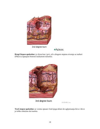 Pruzanje-prve-pomoci-pri-udaru-elektricne-struje | DOC