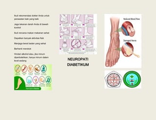 374260335-Leaflet-Neuropati-Diabetik.docx