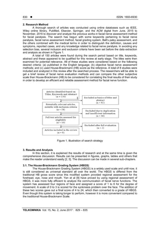Correlation of Objective Assessment of Facial Paralysis with House-Brackmann Score | PDF