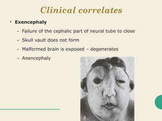 37 Development of the nervous system.pptx