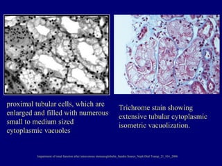 37 ivig related acute kidney injury | PPT