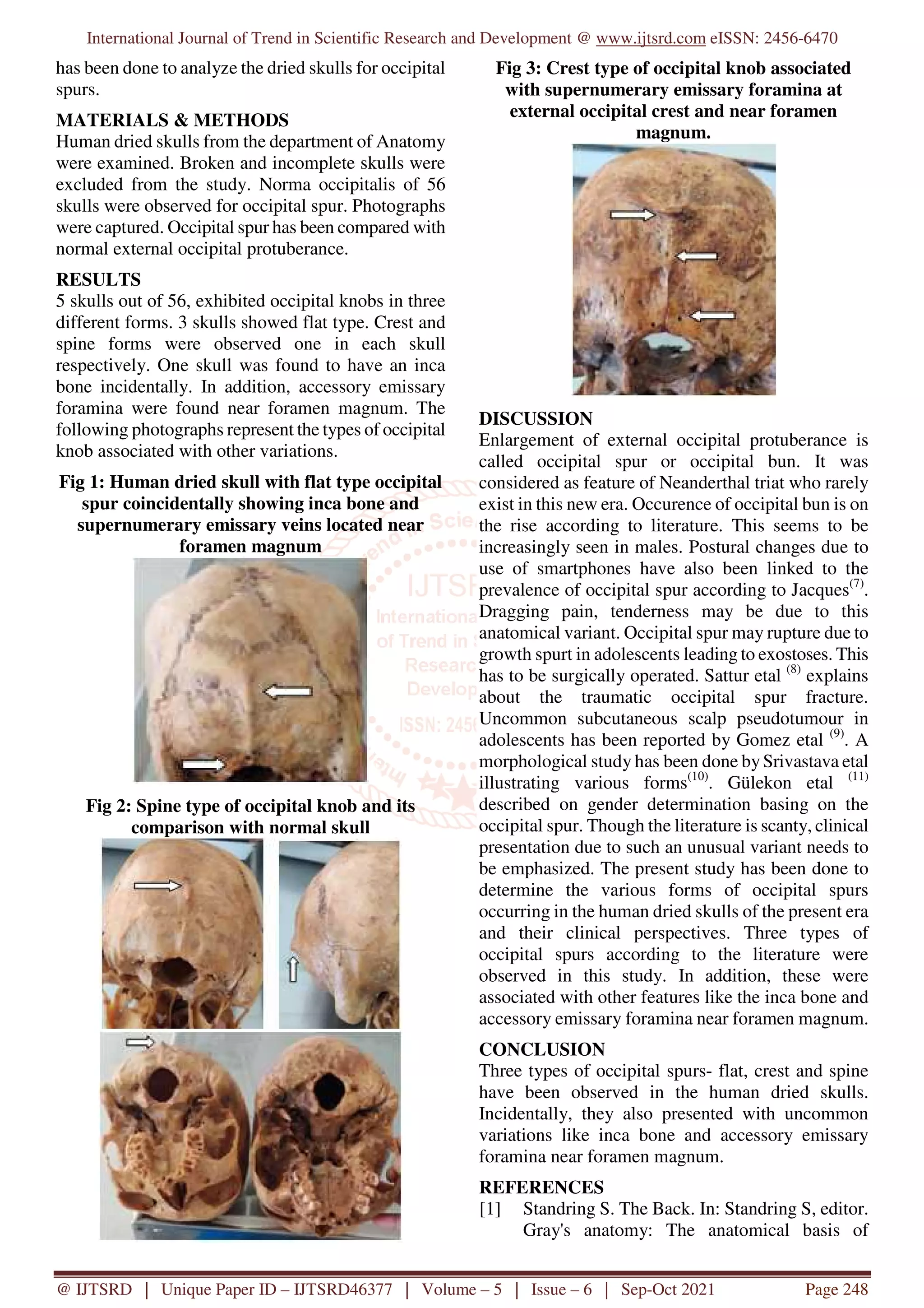 Occipital Knob Morphological Variations in Human Dried Skulls and ...
