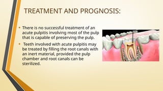 Pulpitis classification Oral Pathology.pptx