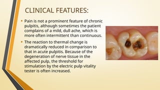 Pulpitis classification Oral Pathology.pptx