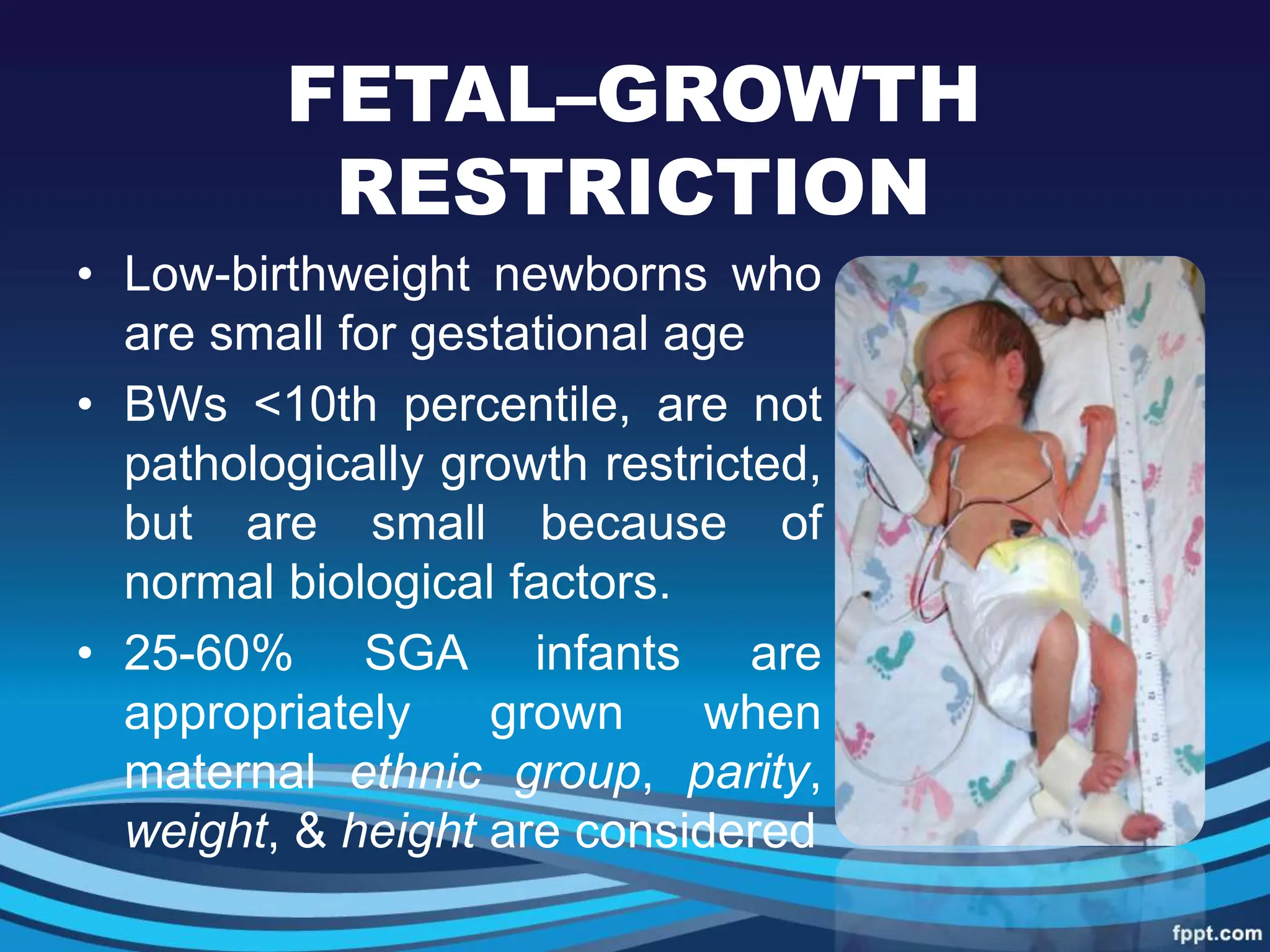 Fetal381503888-Fetal-Growth-Disorders.ppt