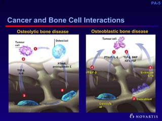 Pathophysiology of Metastatic Bone Disease and the Role of ...