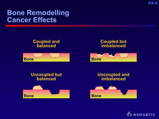 Pathophysiology of Metastatic Bone Disease and the Role of ...