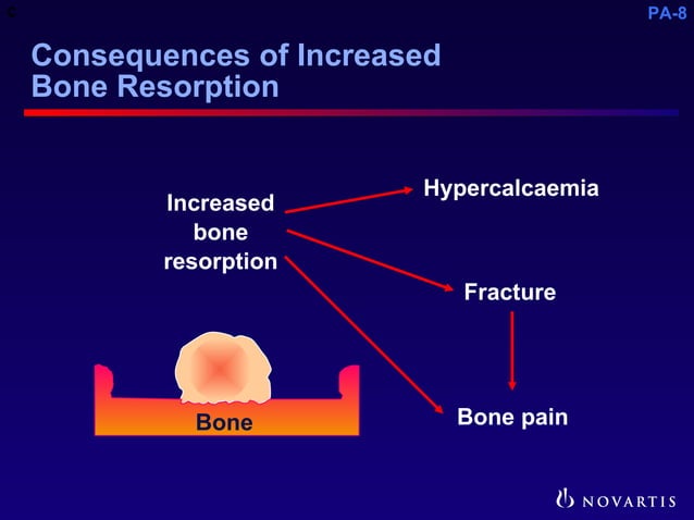 Pathophysiology of Metastatic Bone Disease and the Role of ...