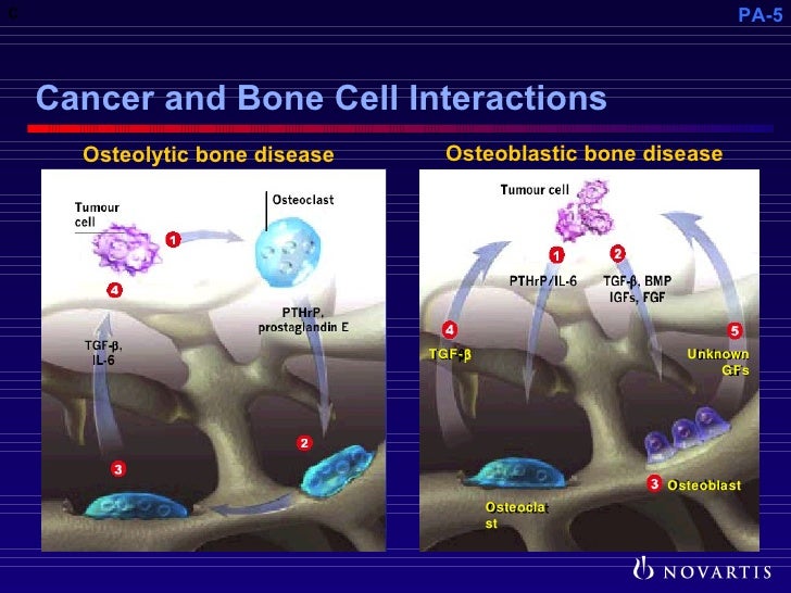 Pathophysiology of vMetastatic Bone Disease and the vRole of Bisphosp…