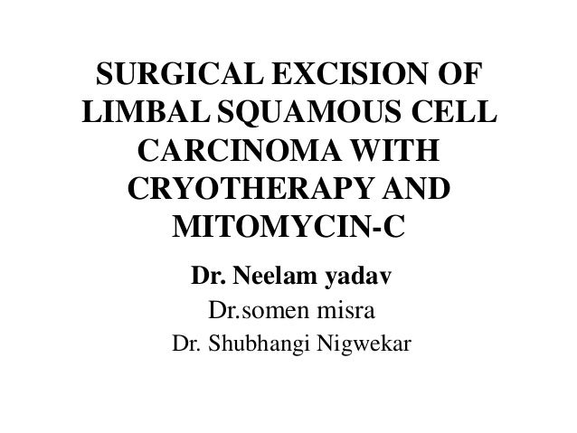 Surgical Excision Of Limbal Squamous Cell Carcinoma With Cryotherapy