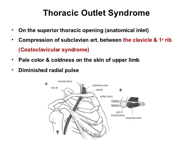 Thoracic Inlet Anatomy