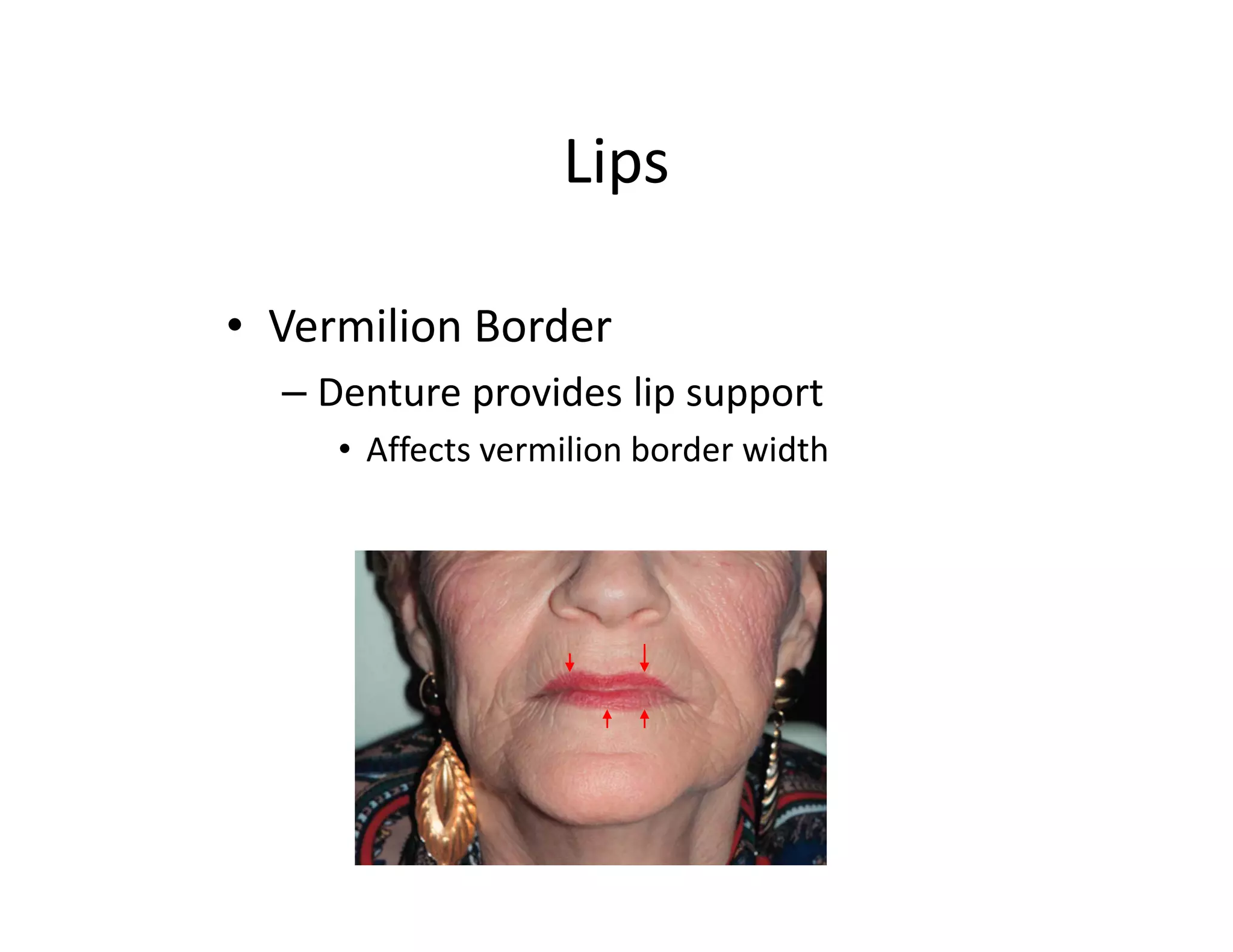 anatomy-for-complete-denture | PDF