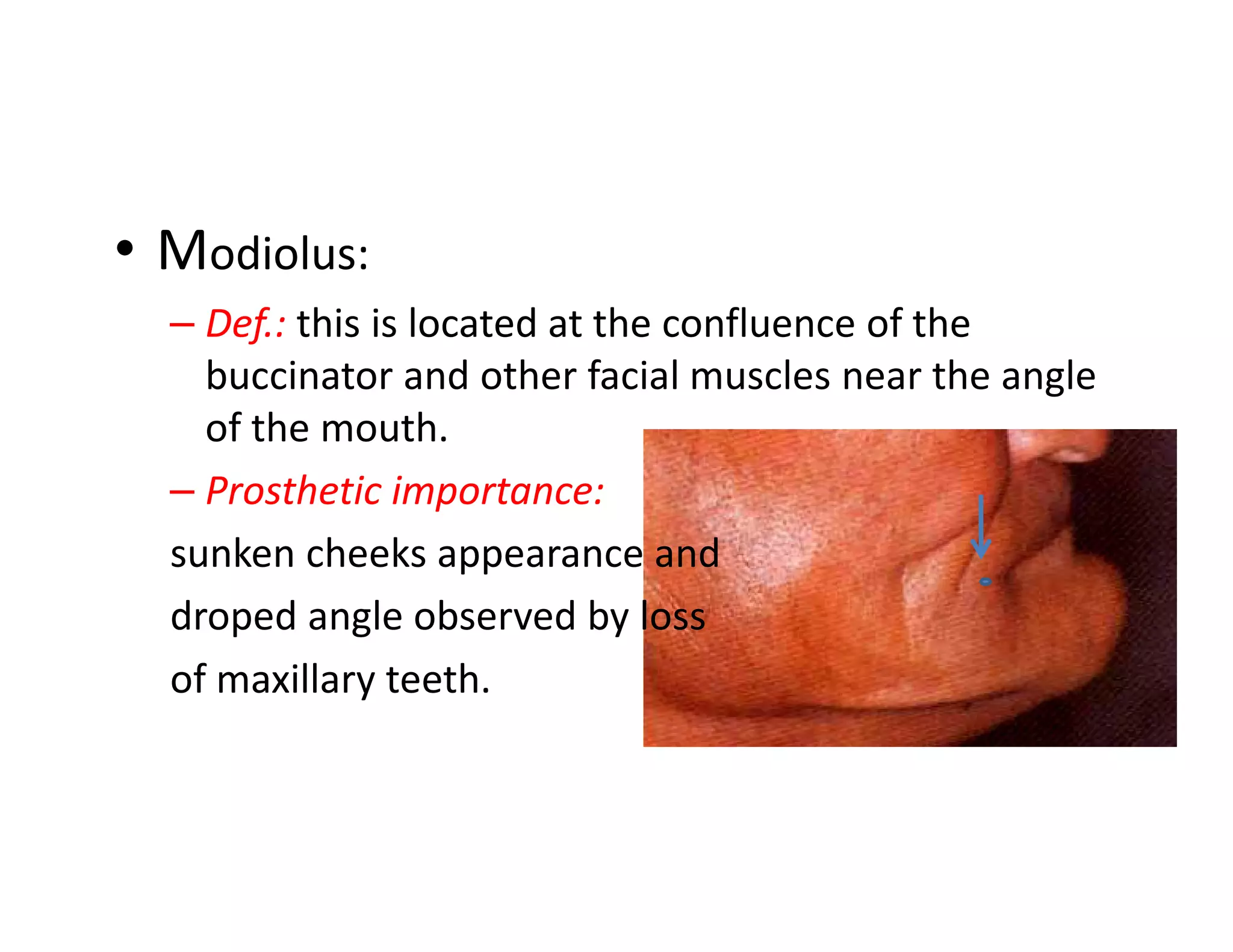 anatomy-for-complete-denture | PDF