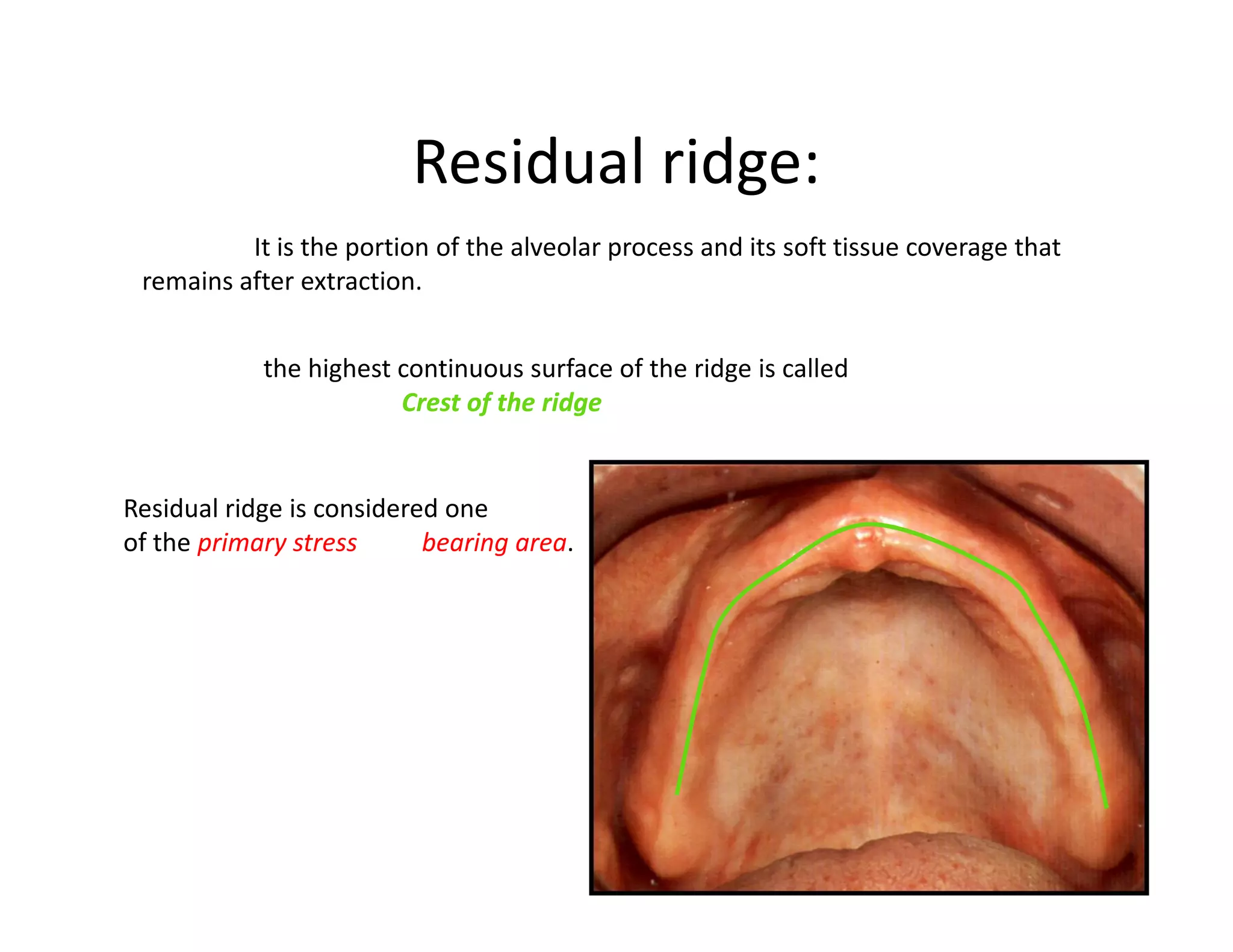 anatomy-for-complete-denture | PDF