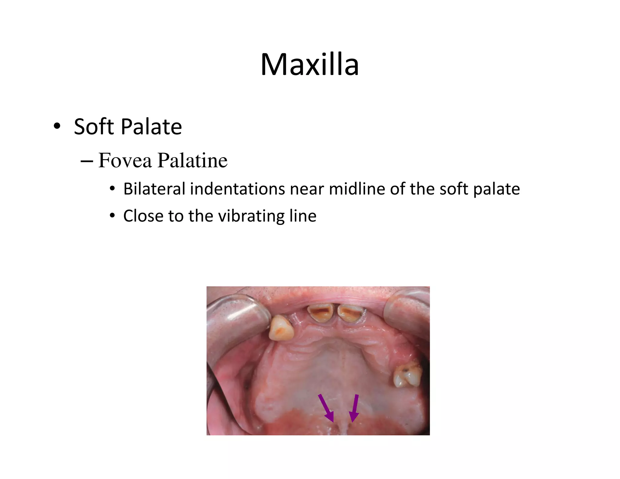 anatomy-for-complete-denture | PDF