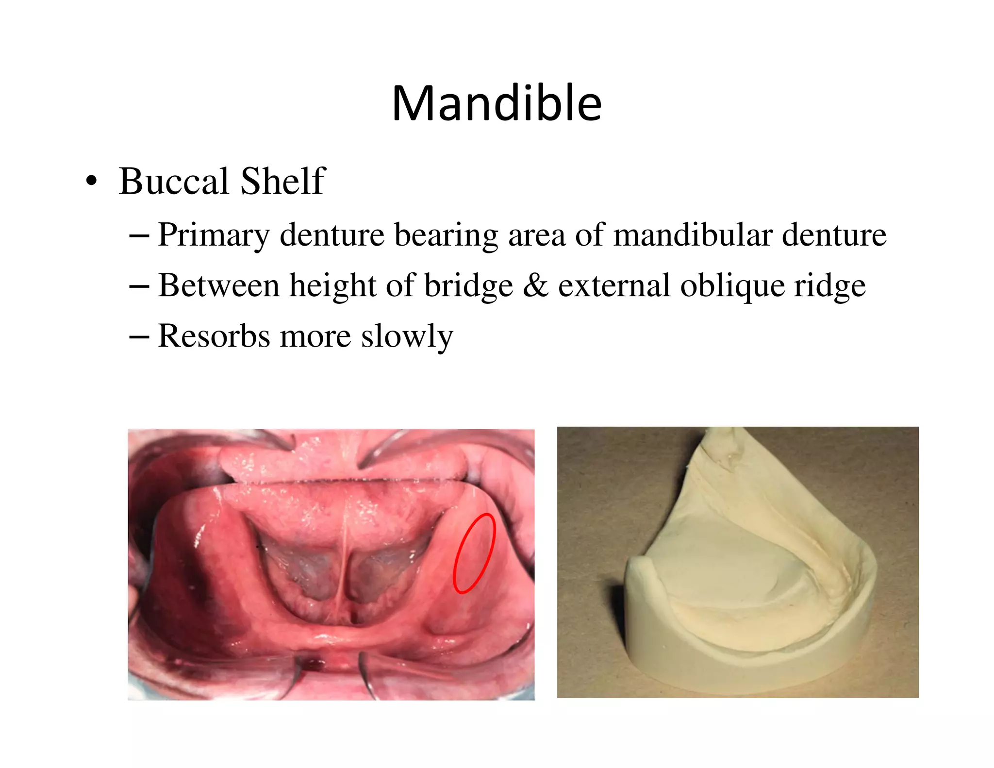 anatomy-for-complete-denture | PDF