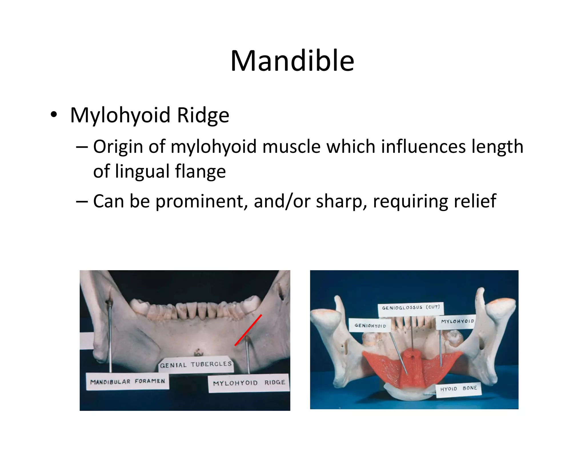 anatomy-for-complete-denture | PDF