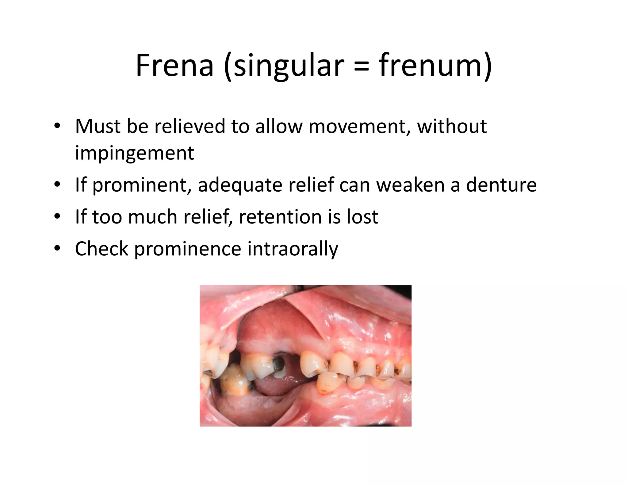 anatomy-for-complete-denture | PDF