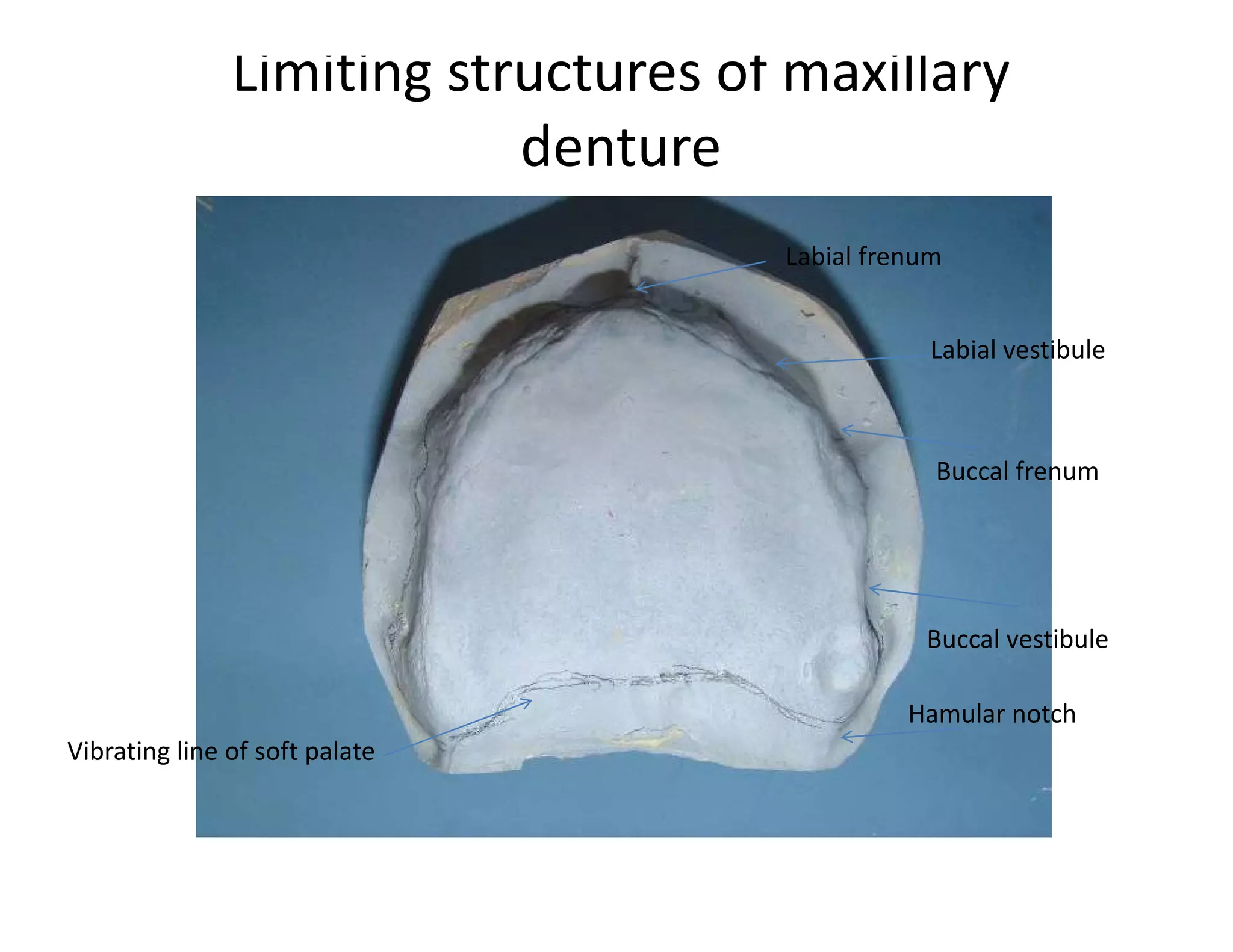 anatomy-for-complete-denture | PDF