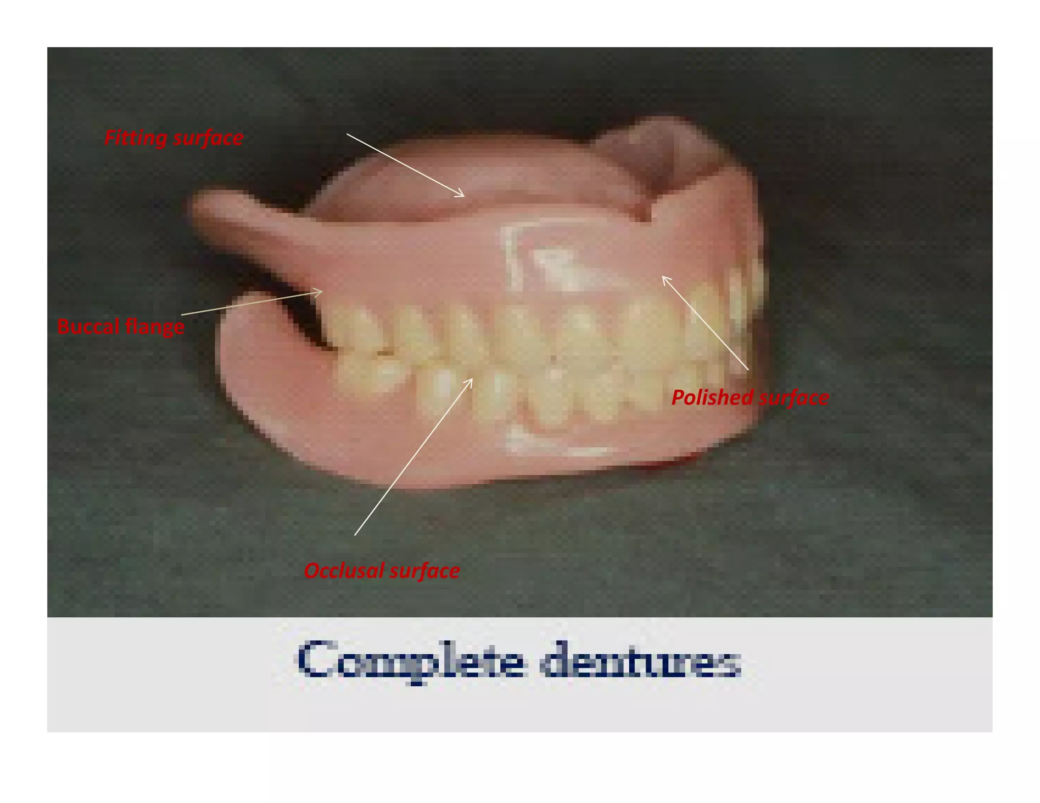 anatomy-for-complete-denture | PDF