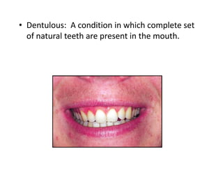 anatomy-for-complete-denture | PDF