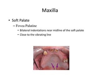 anatomy-for-complete-denture | PDF