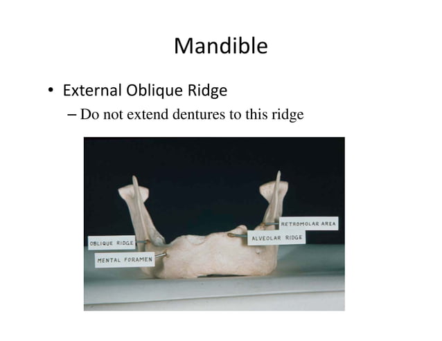anatomy-for-complete-denture | PDF