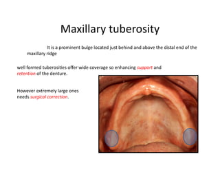 anatomy-for-complete-denture | PPT