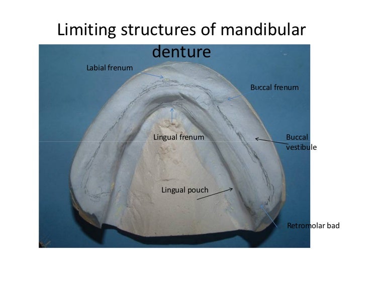 anatomy-for-complete-denture