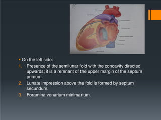 Manoja_Gullapalli_ug | PPT