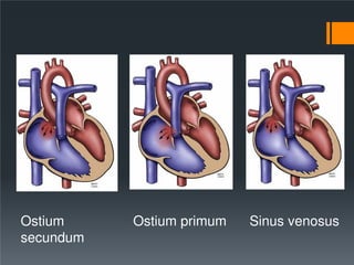 Manoja_Gullapalli_ug | PPT