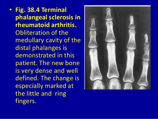 38 DAVID SUTTON PICTURES DISEASES OF JOINT