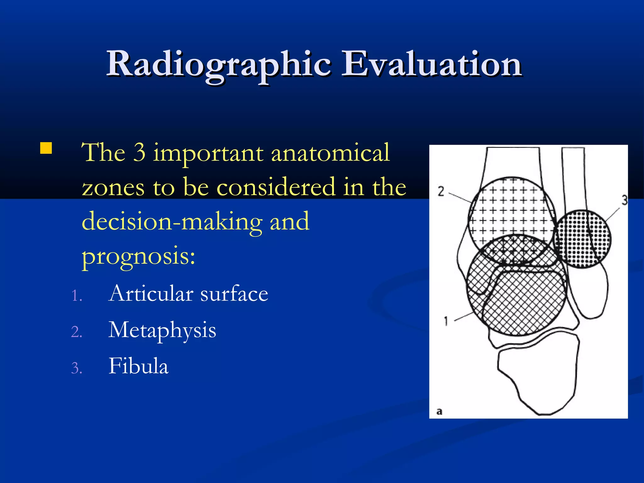 39. tibial plafond (pilon) fractures | PPT