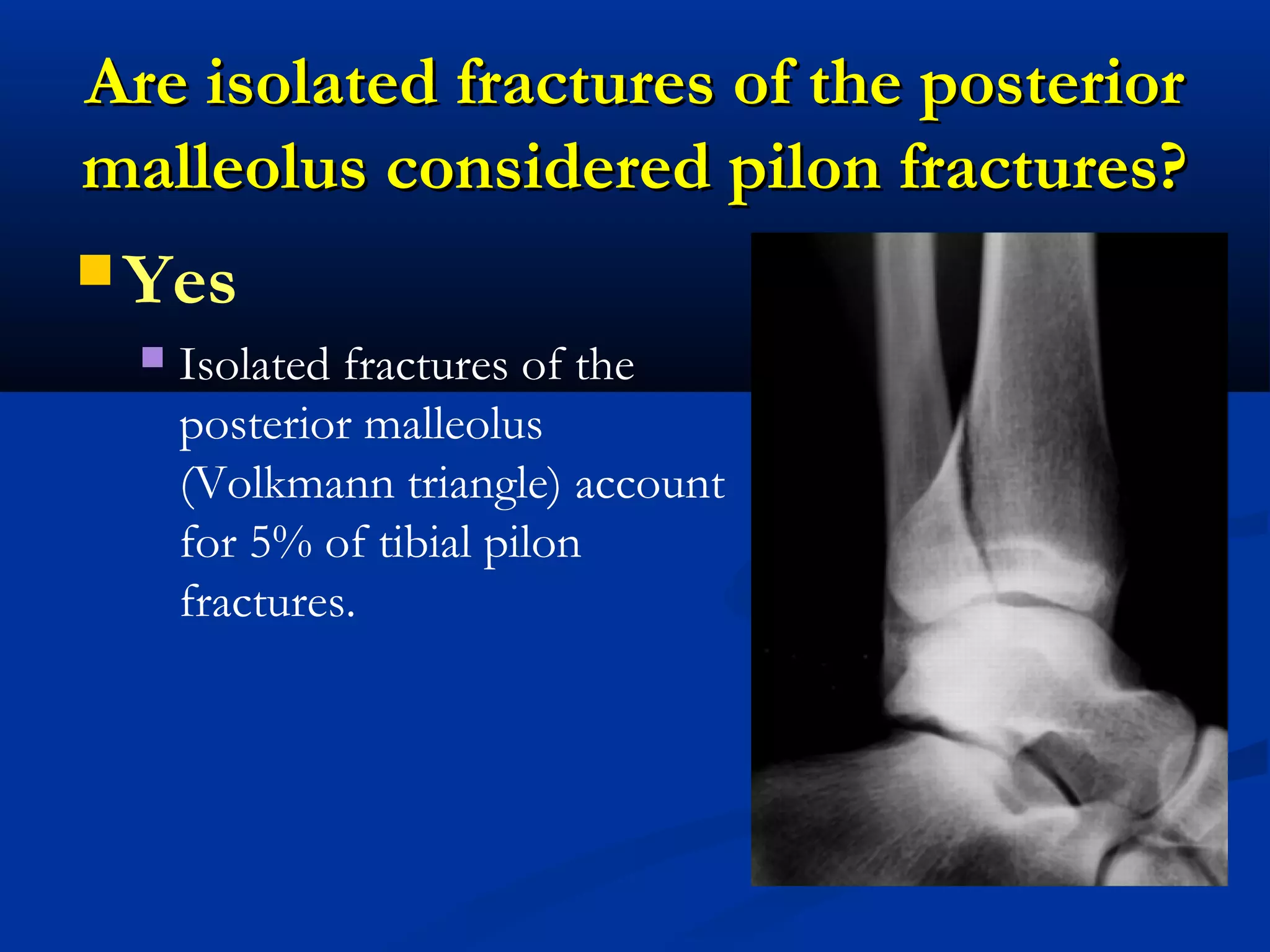 39. tibial plafond (pilon) fractures | PPT