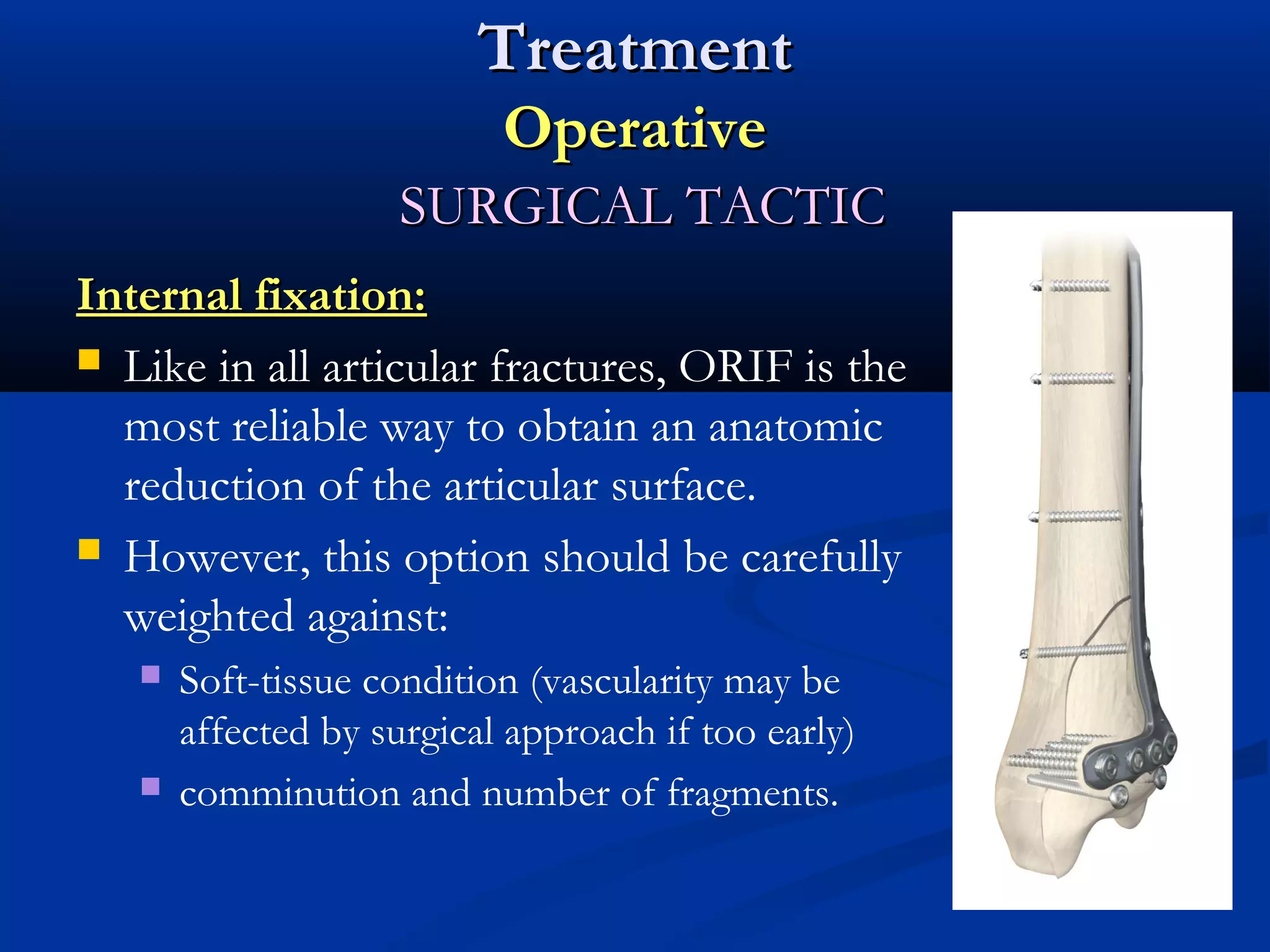 39. tibial plafond (pilon) fractures | PPT