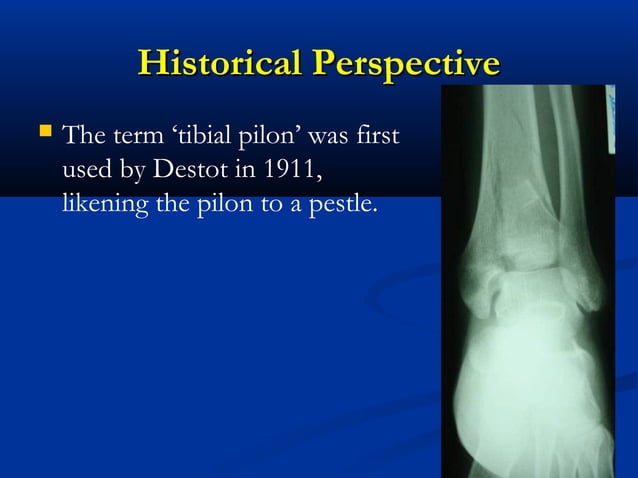 39. tibial plafond (pilon) fractures | PPT | Death, Injury, or Military ...
