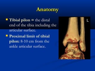 Tibial Plafond