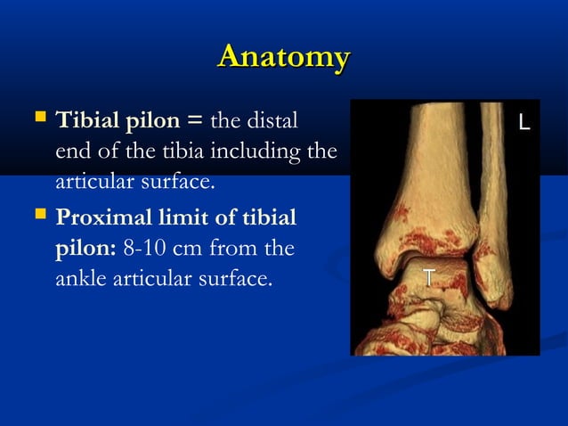 39. tibial plafond (pilon) fractures | PPT | Death, Injury, or Military ...