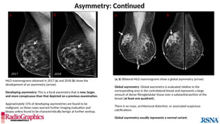 Magnetic resonance imaging breast pptx tool | PPTX