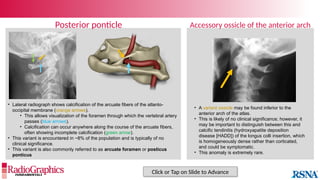 39.3.Skalski.pptx presentation on radiology | PPT