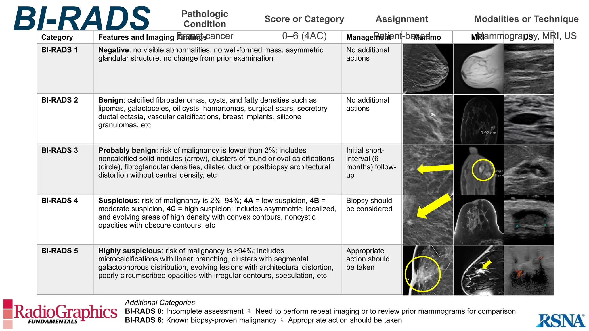 RADS of the americal college of radiology, inlcuding BIRADS, LIRADS ...