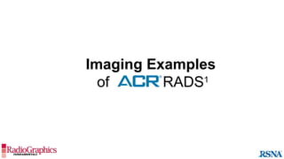 RADS of the americal college of radiology, inlcuding BIRADS, LIRADS ...