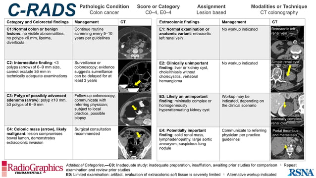 RADS of the americal college of radiology, inlcuding BIRADS, LIRADS ...