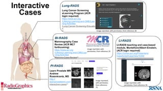 RADS of the americal college of radiology, inlcuding BIRADS, LIRADS ...